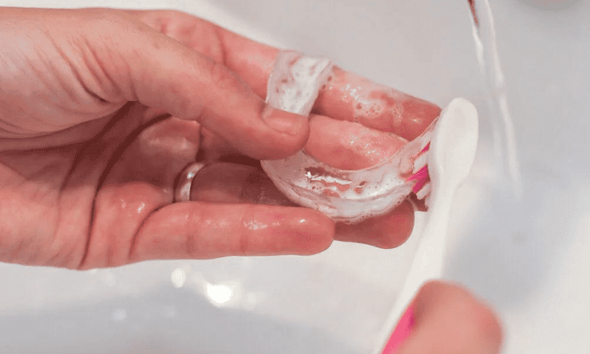 A Step-By-Step Guide on How to Clean Invisalign